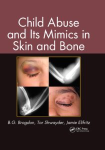 child abuse and its mimics in skin and bone