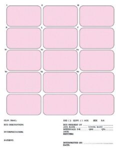 #2421 ecg mounting sheets with patient information - 8.5x11 portrait, 3 column, 15 lead segments (box of 100 mounts)