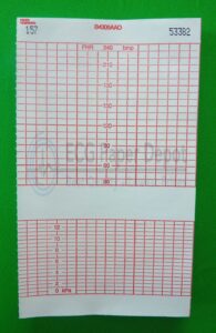 corometrics compatible b4305aao fetal monitoring recording charts, 40 packs per case, z-fold, size 152mm x 47', grid color red