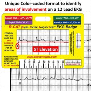 R-CAT EKG Badge