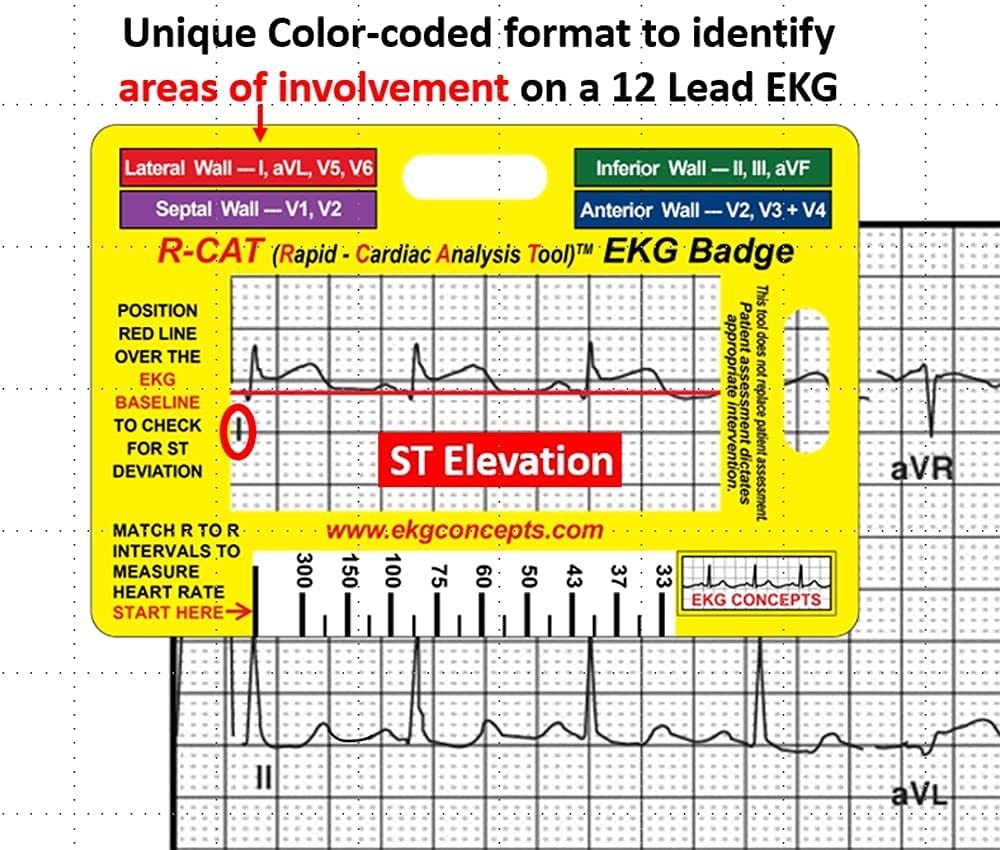 R-CAT EKG Badge