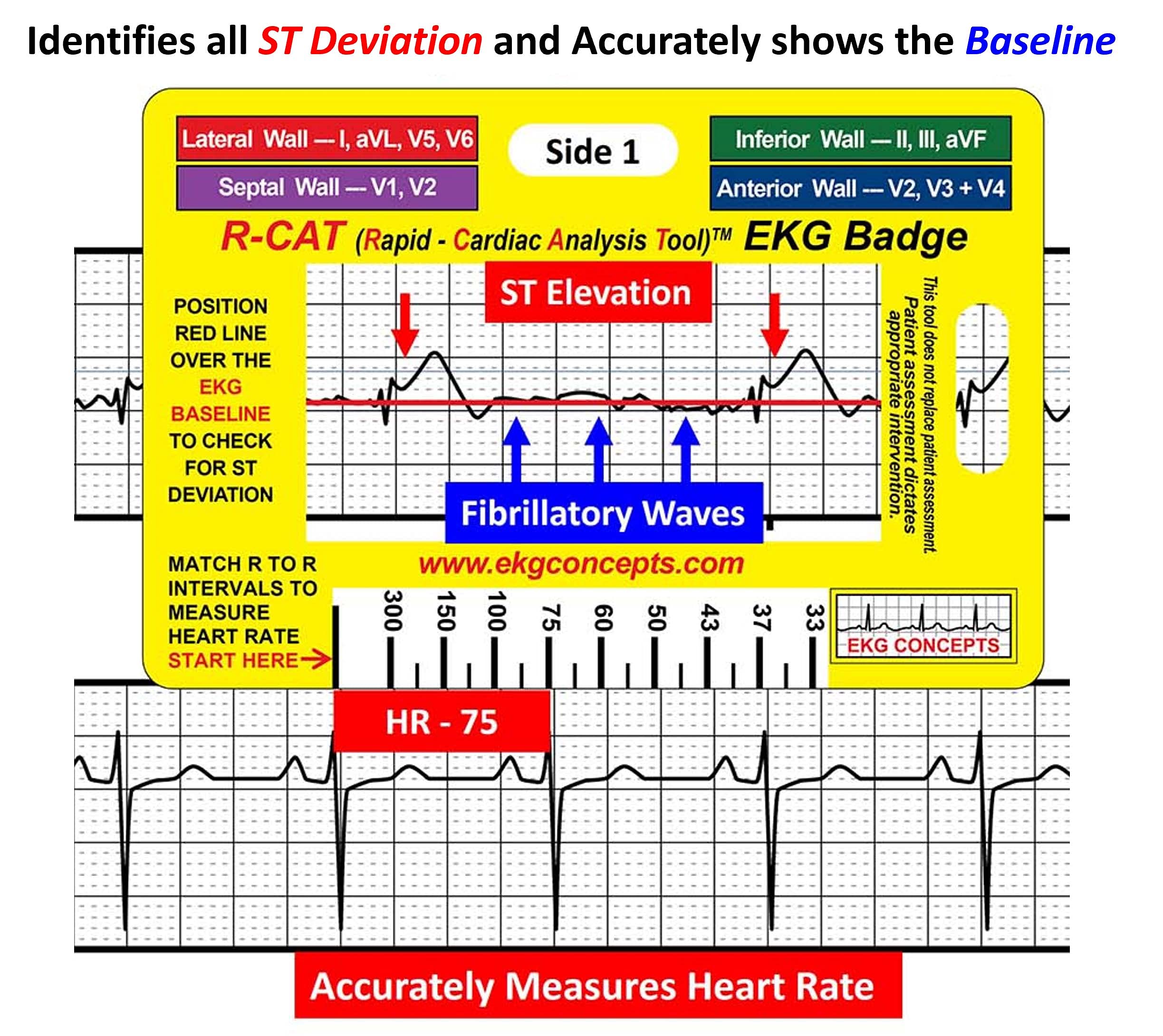 R-CAT EKG Badge