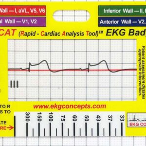 R-CAT EKG Badge