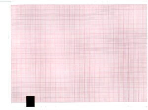 ecg paper 110mm x 140mm x 142sheets (works for fukuda op-222te, fx 7202, edan se 601 series, se-601a, se-601, se-601c, cardio tech crt-6, se-601b, edan se-3, spacelabs sl6, advanced ecg-6) (5)