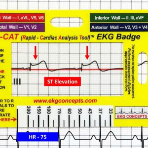 R-CAT EKG Badge