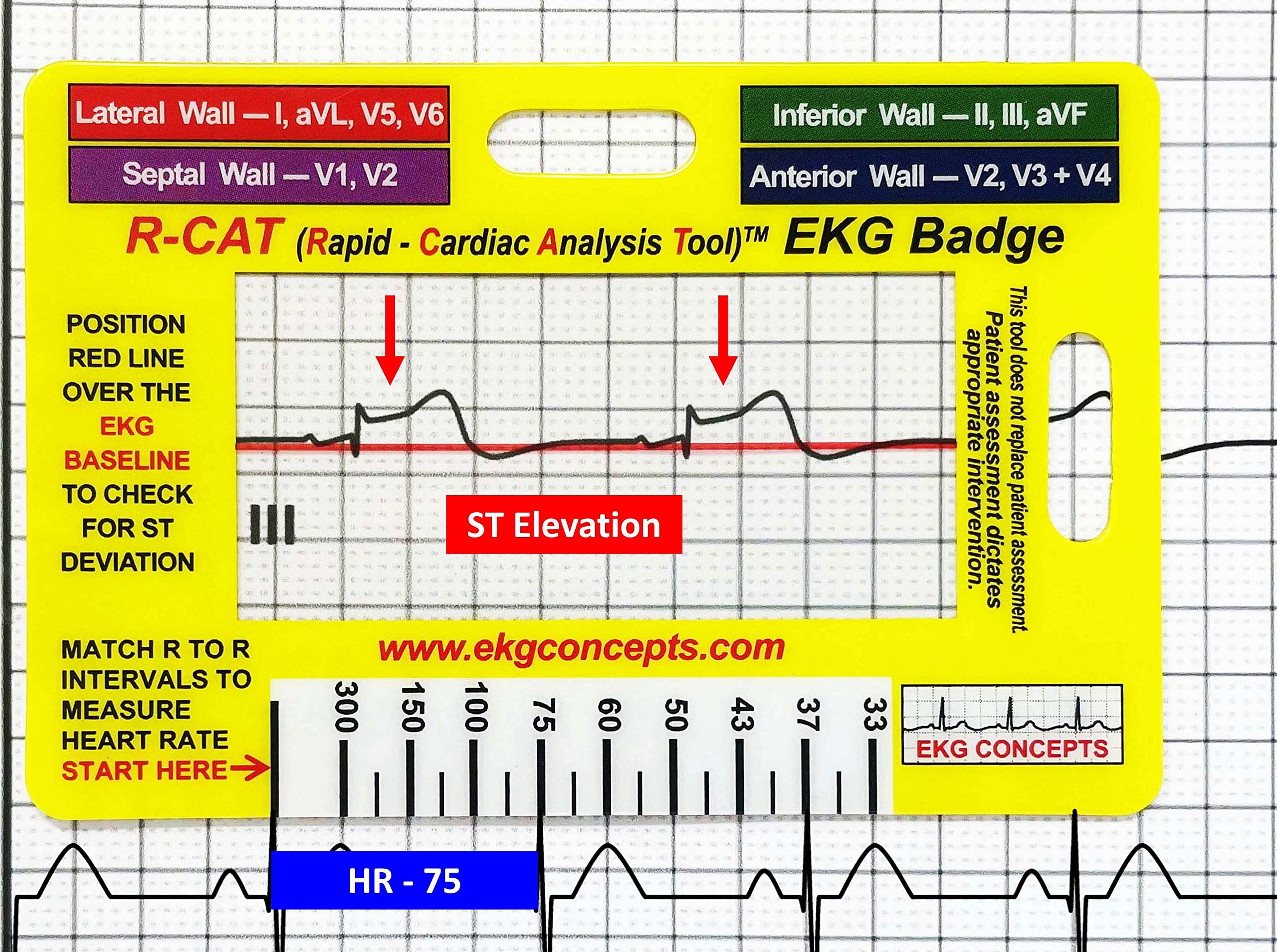 R-CAT EKG Badge