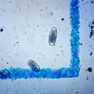 McMaster Method Microscope Slide, FEC (Fecal Egg Count) or Worm Count, Double Chamber Slide for Parasite Testing and Management, Count Parasite Eggs in Horses, Sheep, Goats and Cattle.