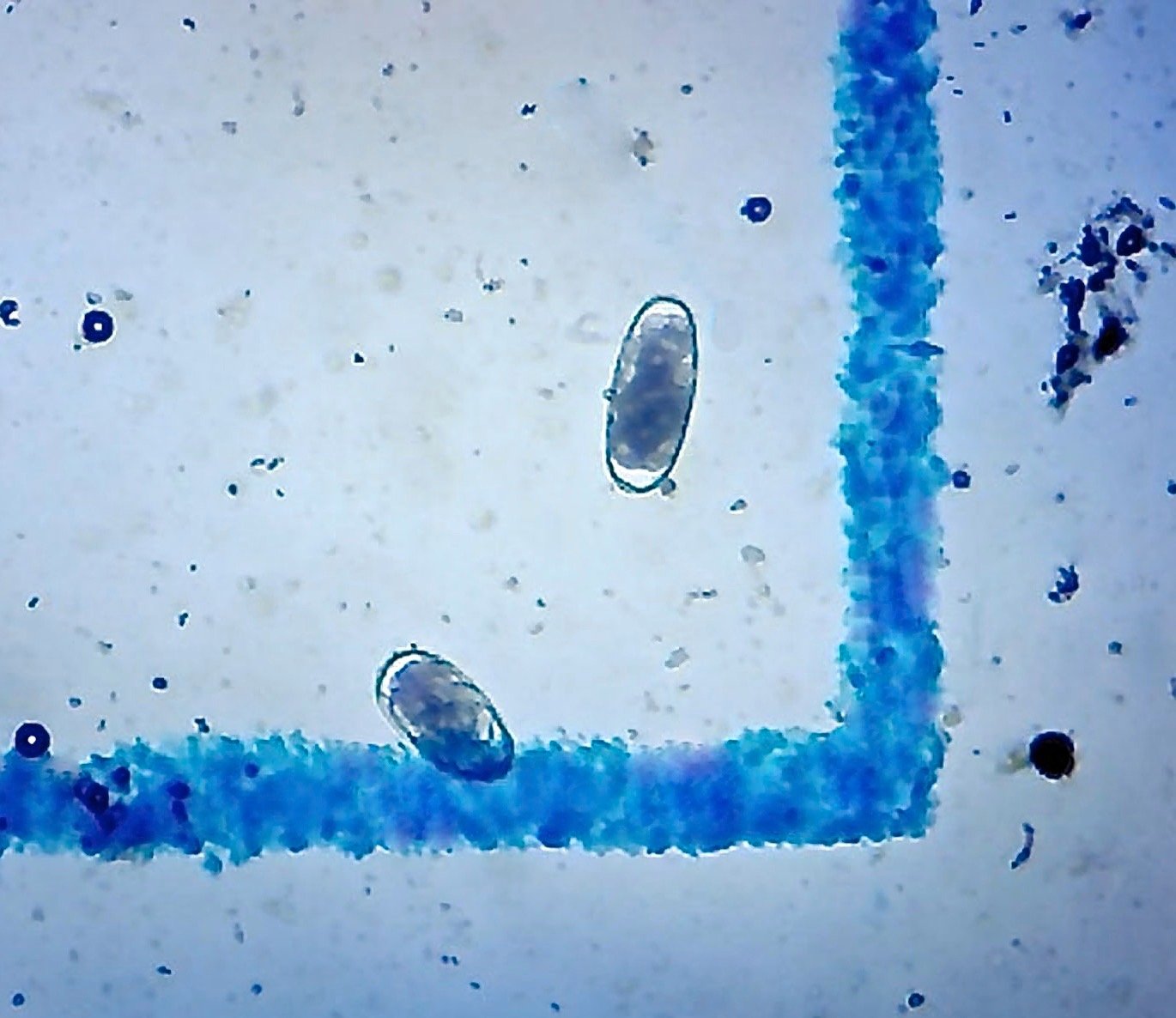 McMaster Method Microscope Slide, FEC (Fecal Egg Count) or Worm Count, Double Chamber Slide for Parasite Testing and Management, Count Parasite Eggs in Horses, Sheep, Goats and Cattle.