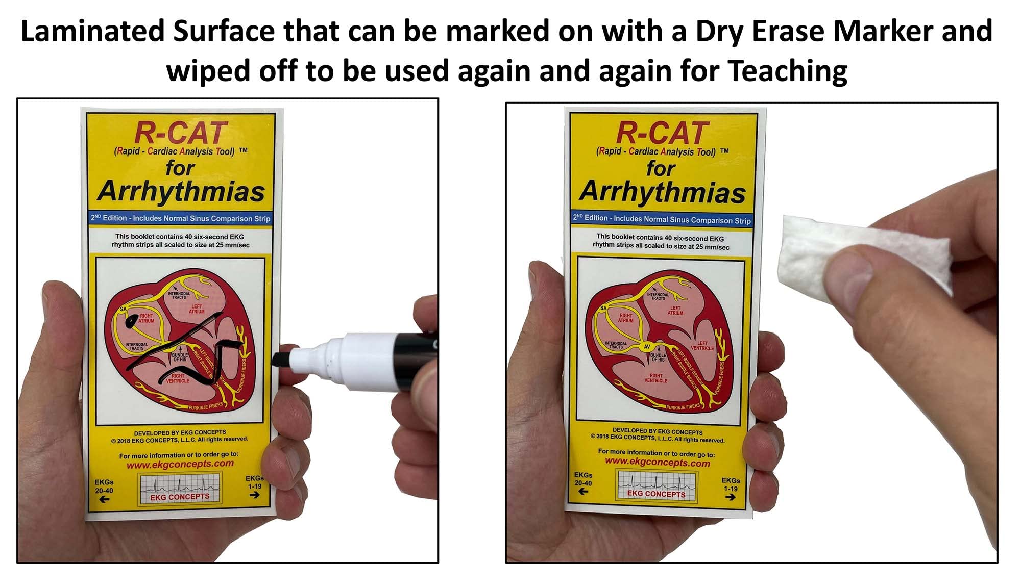 R-CAT for Arrhythmias EKG Pocket Reference Guide – Great Study Card for EKG Interpretation - ACLS and PALS Training – Cardiac Rhythm Interpretation Made Easy