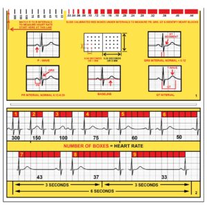 R-CAT for Arrhythmias EKG Pocket Reference Guide – Great Study Card for EKG Interpretation - ACLS and PALS Training – Cardiac Rhythm Interpretation Made Easy