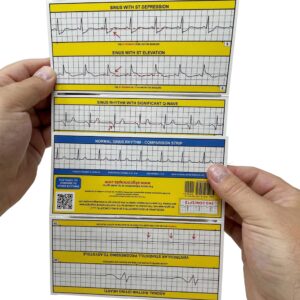 R-CAT for Arrhythmias EKG Pocket Reference Guide – Great Study Card for EKG Interpretation - ACLS and PALS Training – Cardiac Rhythm Interpretation Made Easy