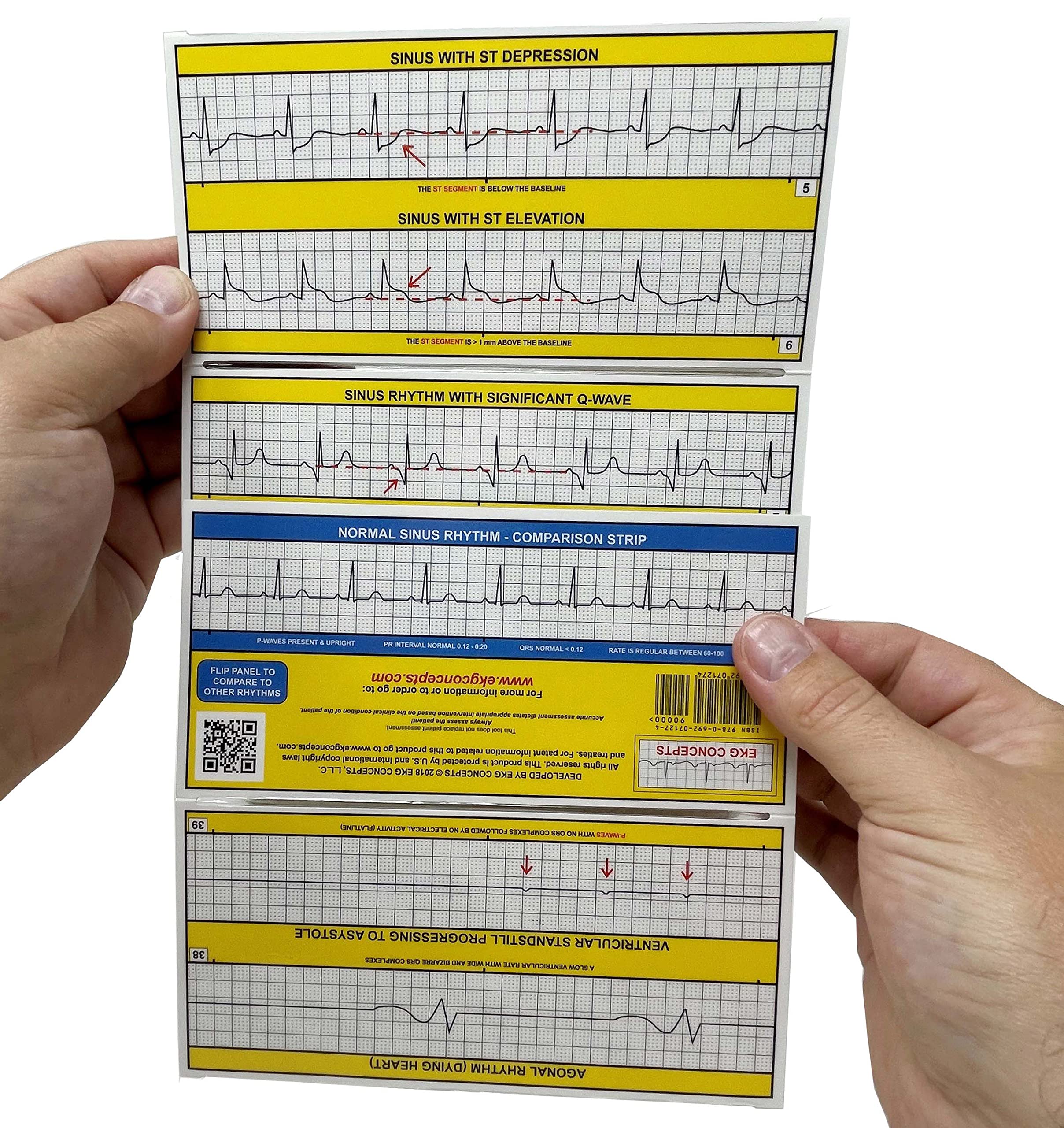 R-CAT for Arrhythmias EKG Pocket Reference Guide – Great Study Card for EKG Interpretation - ACLS and PALS Training – Cardiac Rhythm Interpretation Made Easy