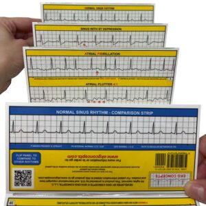 R-CAT for Arrhythmias EKG Pocket Reference Guide – Great Study Card for EKG Interpretation - ACLS and PALS Training – Cardiac Rhythm Interpretation Made Easy