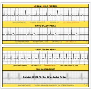 R-CAT for Arrhythmias EKG Pocket Reference Guide – Great Study Card for EKG Interpretation - ACLS and PALS Training – Cardiac Rhythm Interpretation Made Easy