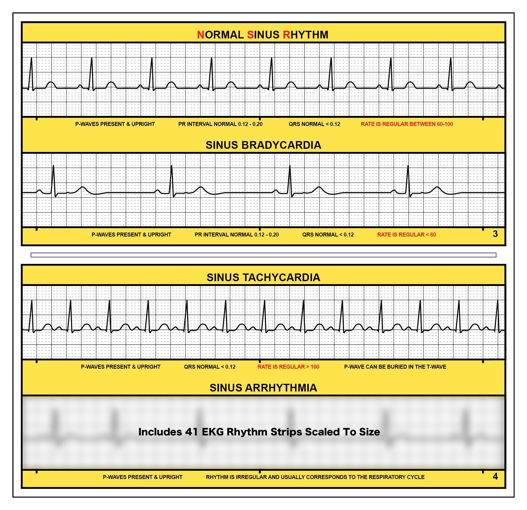 R-CAT for Arrhythmias EKG Pocket Reference Guide – Great Study Card for EKG Interpretation - ACLS and PALS Training – Cardiac Rhythm Interpretation Made Easy