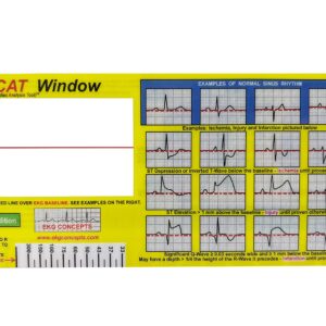 R-CAT EKG Window 2nd Edition