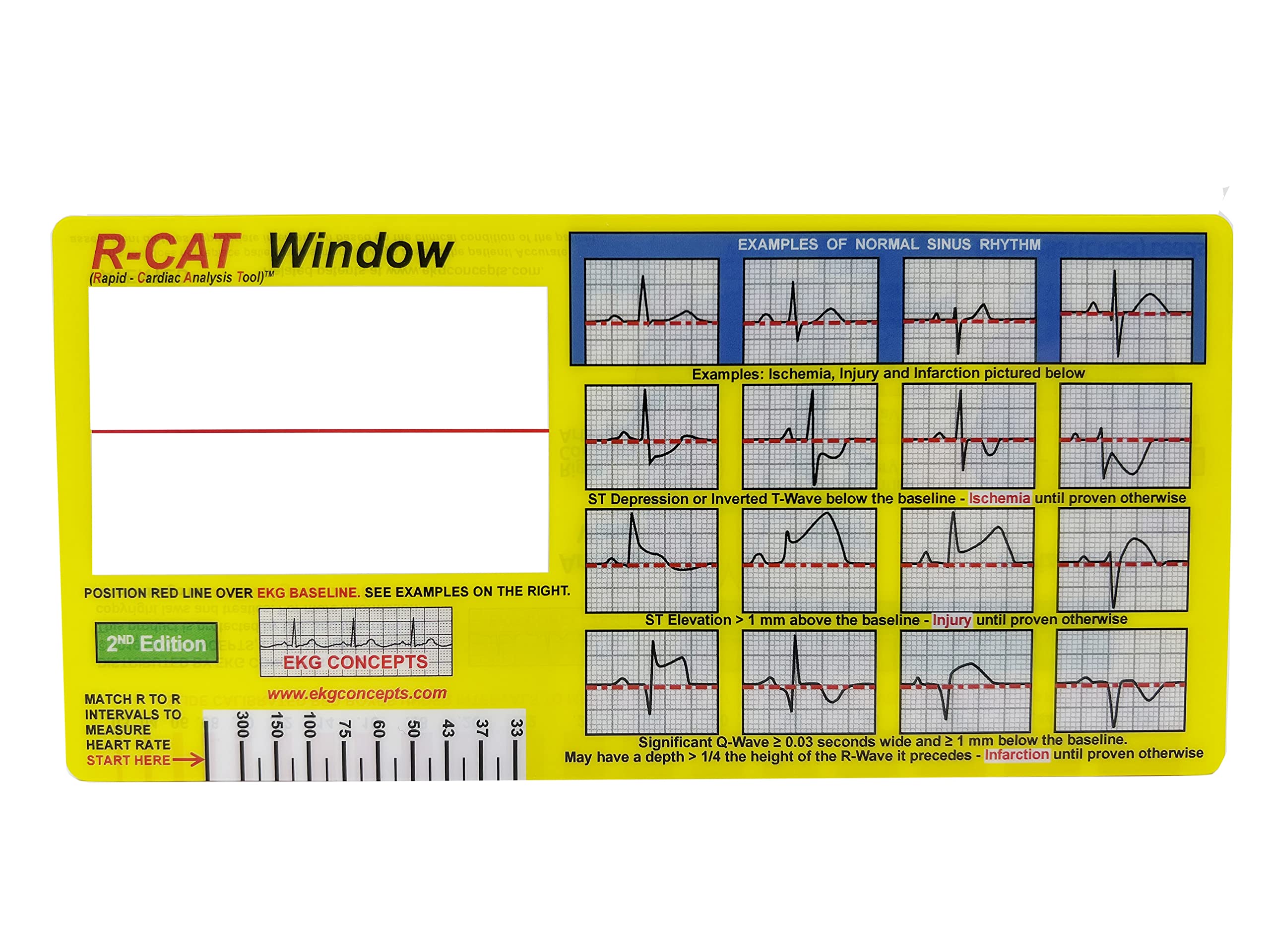 R-CAT EKG Window 2nd Edition