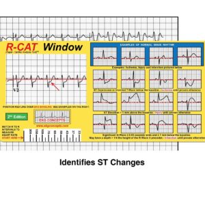 R-CAT EKG Window 2nd Edition