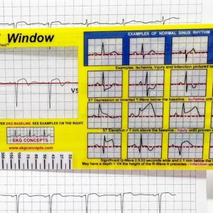 R-CAT EKG Window 2nd Edition