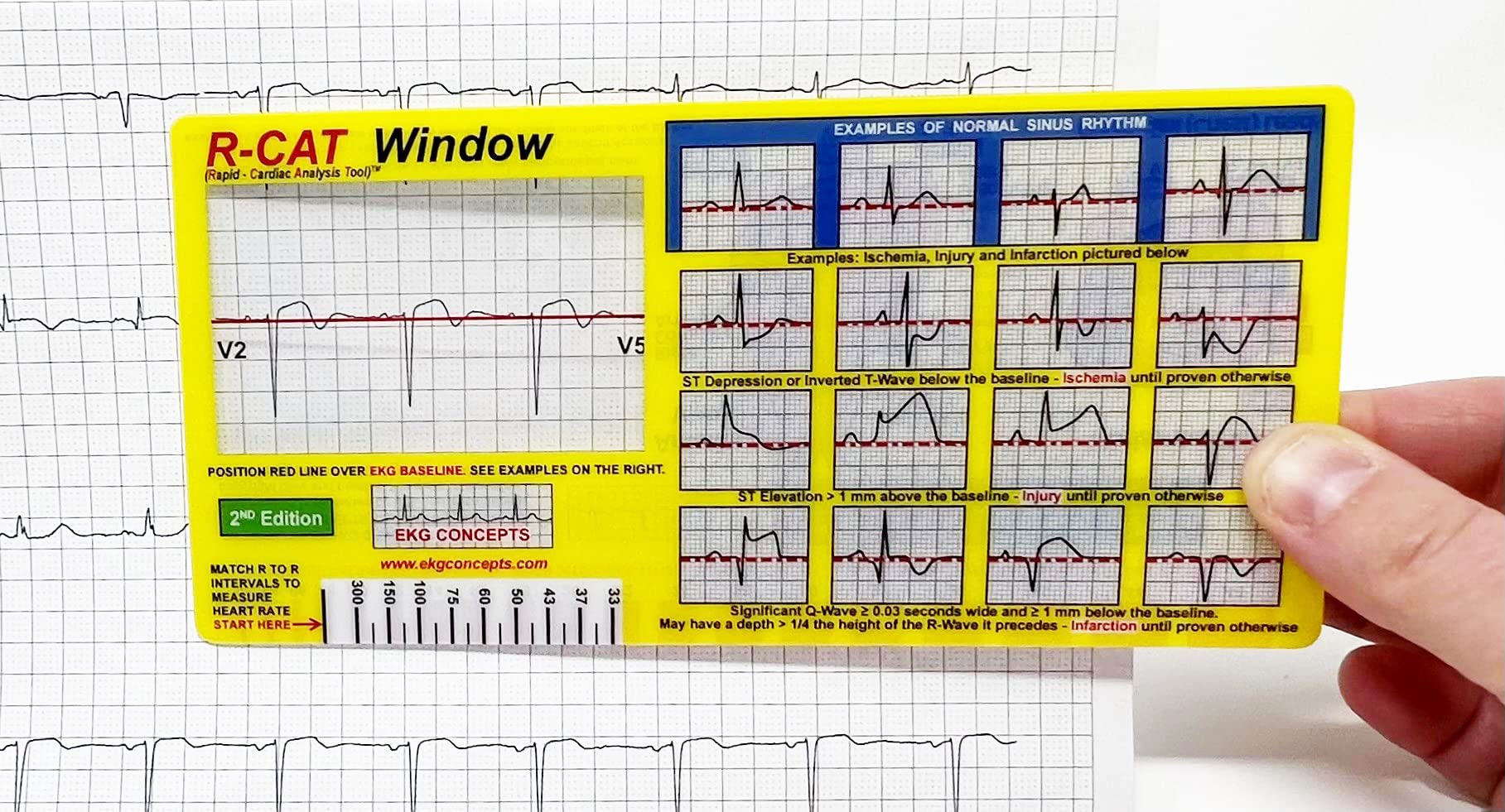 R-CAT EKG Window 2nd Edition