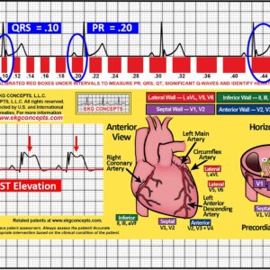 R-CAT EKG Window 2nd Edition