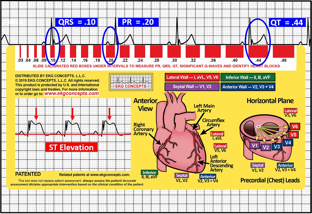 R-CAT EKG Window 2nd Edition