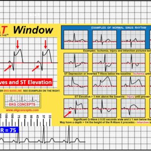 R-CAT EKG Window 2nd Edition