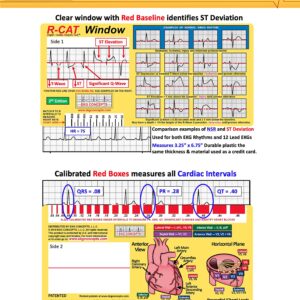 R-CAT EKG Window 2nd Edition