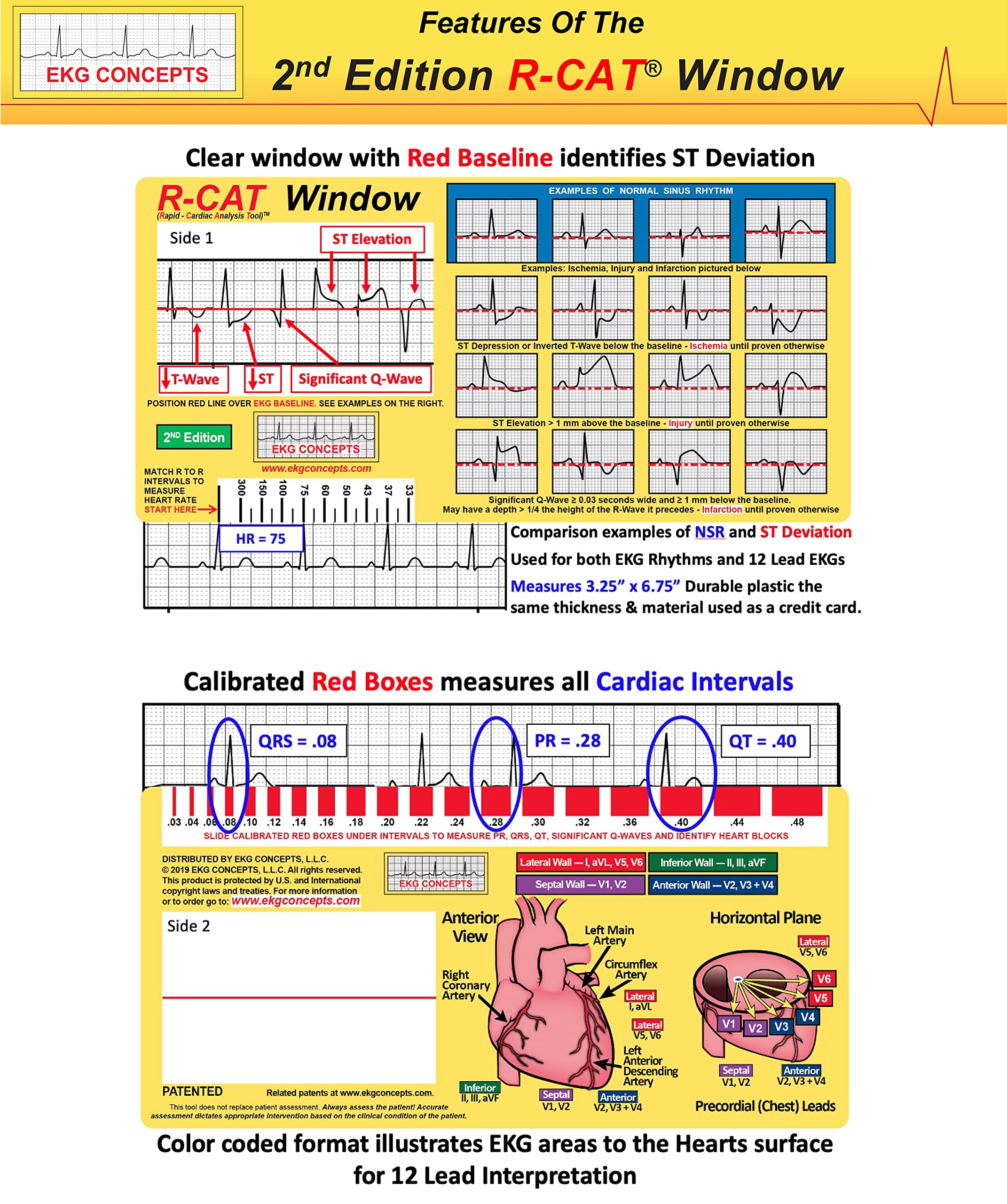 R-CAT EKG Window 2nd Edition