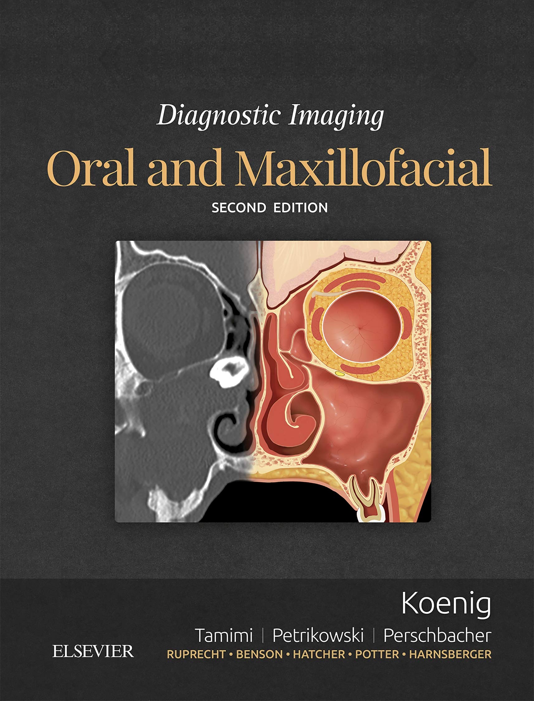 Diagnostic Imaging: Oral and Maxillofacial: Diagnostic Imaging: Oral and Maxillofacial E-Book