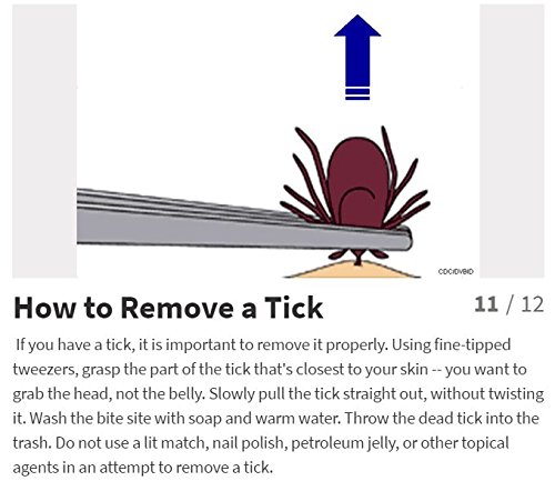 eTradewinds Tick Remover Tool Kit Tweezers & Tick Identifier Card - Hygienic All Stainless Steel Tick Removal Instrument Ideal for Human, Dog, Cat & General Pet Tick Puller w/Leather Case