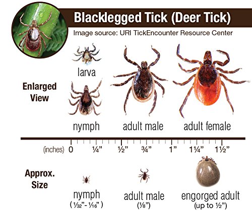 eTradewinds Tick Remover Tool Kit Tweezers & Tick Identifier Card - Hygienic All Stainless Steel Tick Removal Instrument Ideal for Human, Dog, Cat & General Pet Tick Puller w/Leather Case