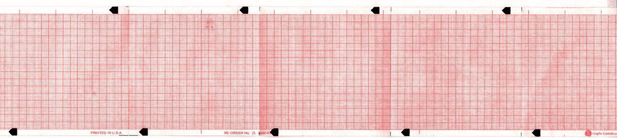 Vermed Medical Chart Paper for Zoll