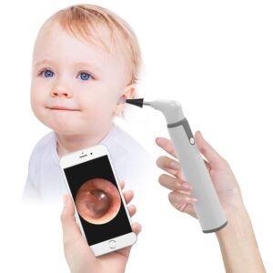 wireless otoscope, ear scope with 720p hd ear camera and 6 led lights, ear wax removal tool camera with gyroscope, digital otoscope with light, compatible with iphone and android