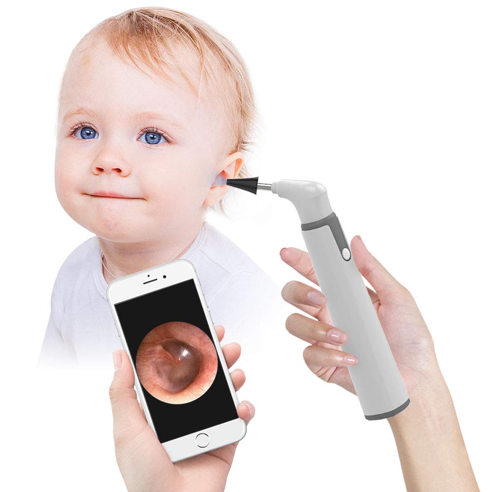 Wireless Otoscope, Ear Scope with 720P HD Ear Camera and 6 LED Lights, Ear Wax Removal Tool Camera with Gyroscope, Digital Otoscope with Light, Compatible with iPhone and Android