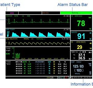 PM6000VP 12" Veterinary Multi-Parameter Monitor with ECG RESP SpO2 NIBP Temp PR Printer