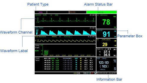 PM6000VP 12" Veterinary Multi-Parameter Monitor with ECG RESP SpO2 NIBP Temp PR Printer