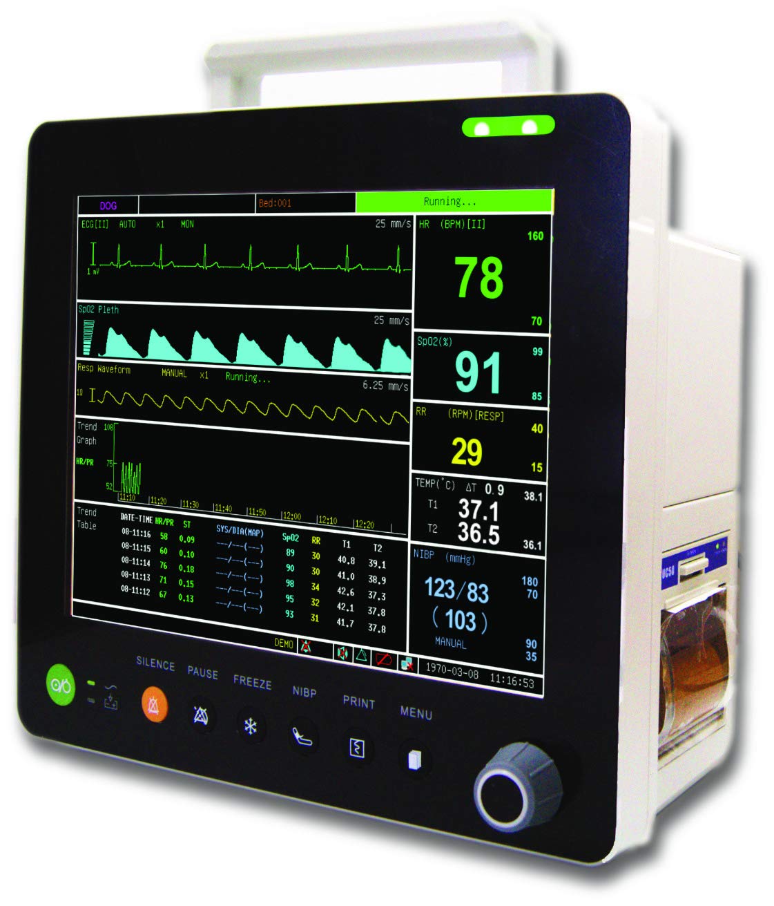 PM6000VP 12" Veterinary Multi-Parameter Monitor with ECG RESP SpO2 NIBP Temp PR Printer