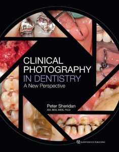 clinical photography in dentistry: a new perspective