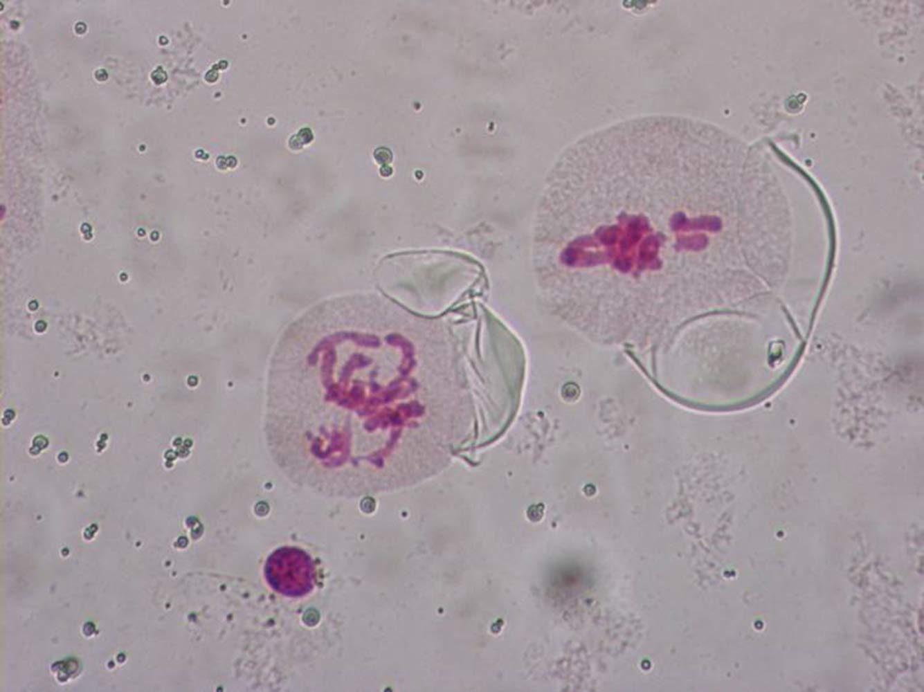 Prepared Animal Plant Cell Mitosis Meiosis Amitosis Comparison Microscope Slides Set, 5pcs Specimens to Display with Students in Biology Class (Mitosis & Meiosis)