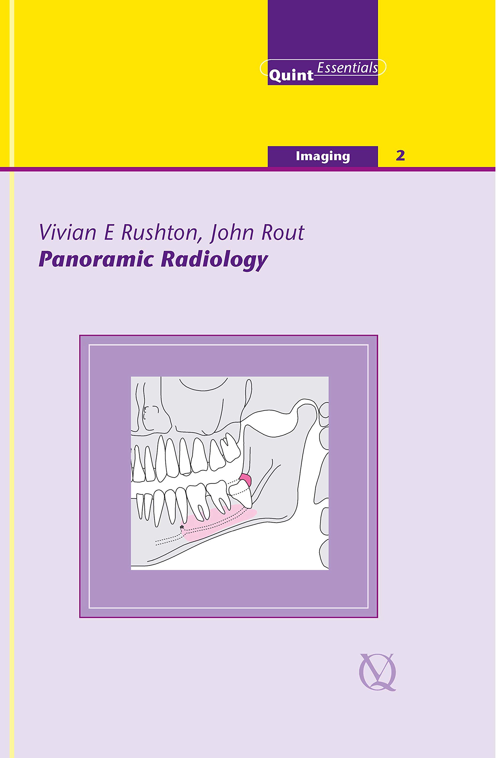 Panoramic Radiology: Imaging - 2 (QuintEssentials of Dental Practice Book 20)