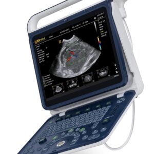 BPU60V Hand-Carried 15" Color Doppler Ultrasound System equine, large animal, small animal, zoo mammal, and marine mammal medicine body scans Abdomen, Reproduction, Gynecology, Cardiology, Small Parts