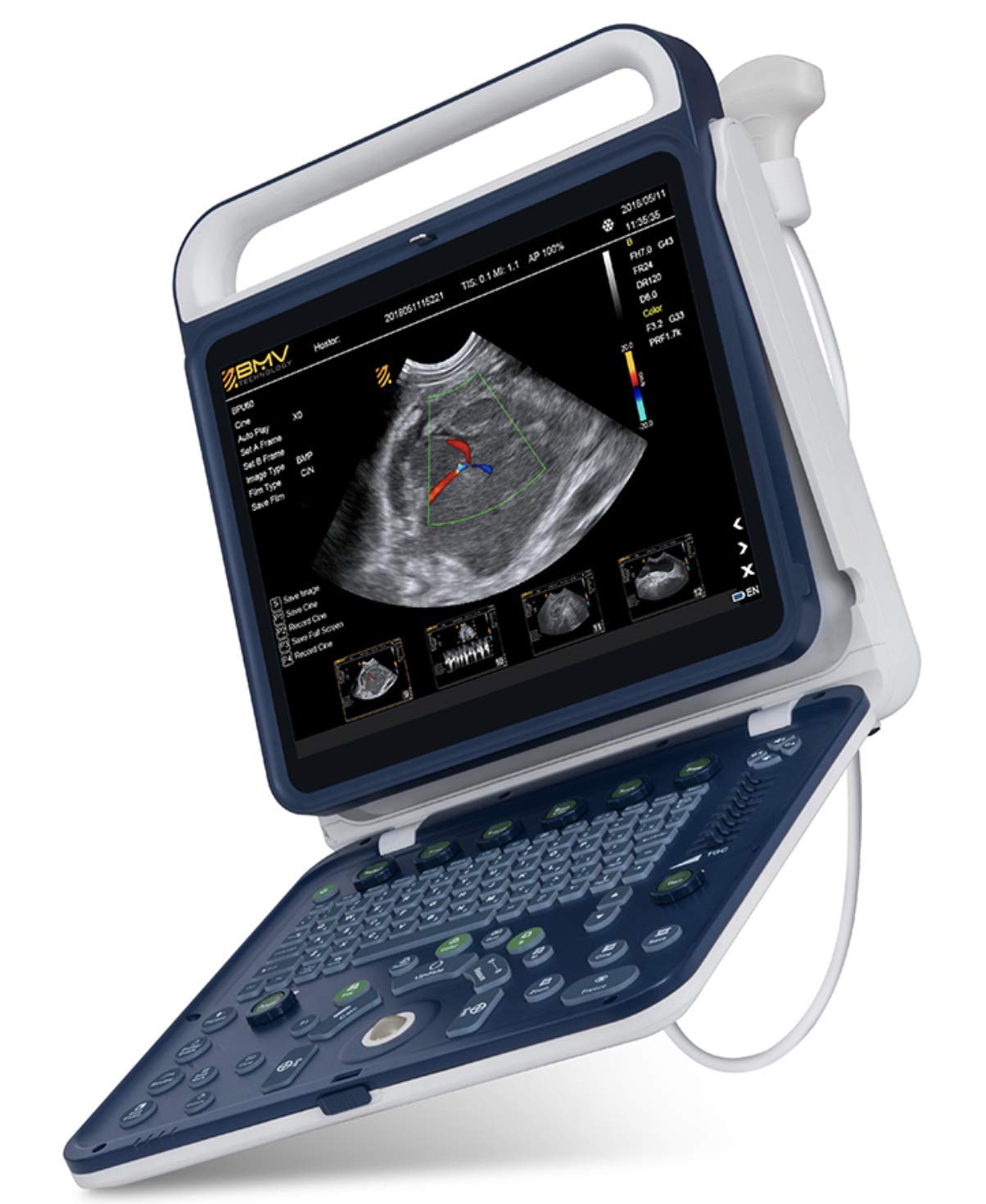 BPU60V Hand-Carried 15" Color Doppler Ultrasound System equine, large animal, small animal, zoo mammal, and marine mammal medicine body scans Abdomen, Reproduction, Gynecology, Cardiology, Small Parts