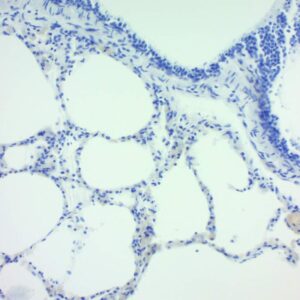 Hematoxylin, Mayer's (Lillie's Modification), 1000ml