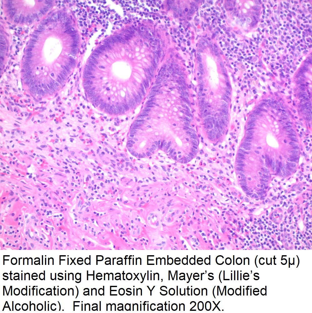 Hematoxylin, Mayer's (Lillie's Modification), 1000ml