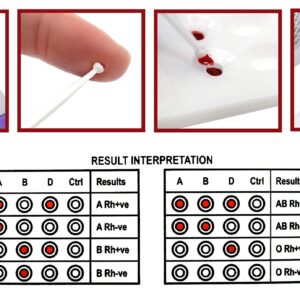 ALDON Innovating Science ABO/RH Blood Type Test Kit - Educational Use, Erycard Blood Grouping Card, Buffer Solution, Alcohol Wipe, Lancet, Collection Sticks, Instructions - Home Blood Type Testing Kit