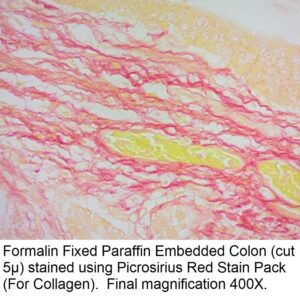 Picrosirius Red Stain Pack (for Collagen), 250ml