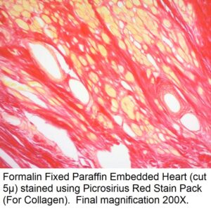 Picrosirius Red Stain Pack (for Collagen), 250ml