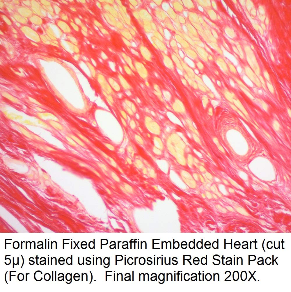 Picrosirius Red Stain Pack (for Collagen), 250ml