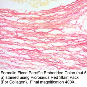 Picrosirius Red Stain Pack (for Collagen), 250ml